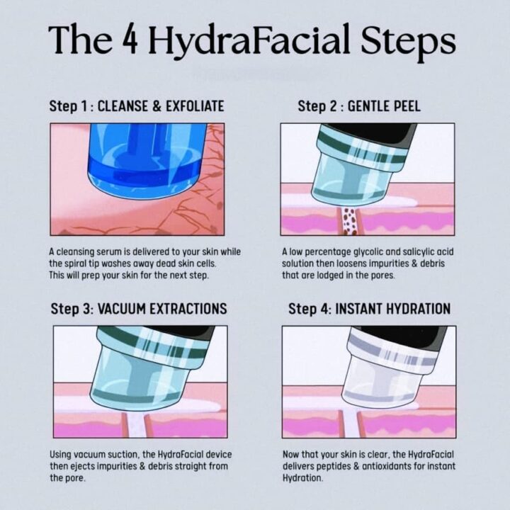 How To Do Hydrafacial In 4 Steps (InfoVis)