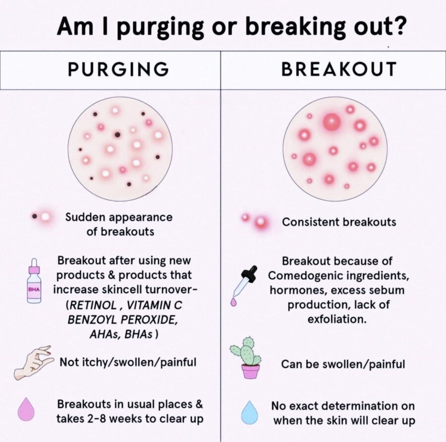 Purging vs Breakout (Chart)