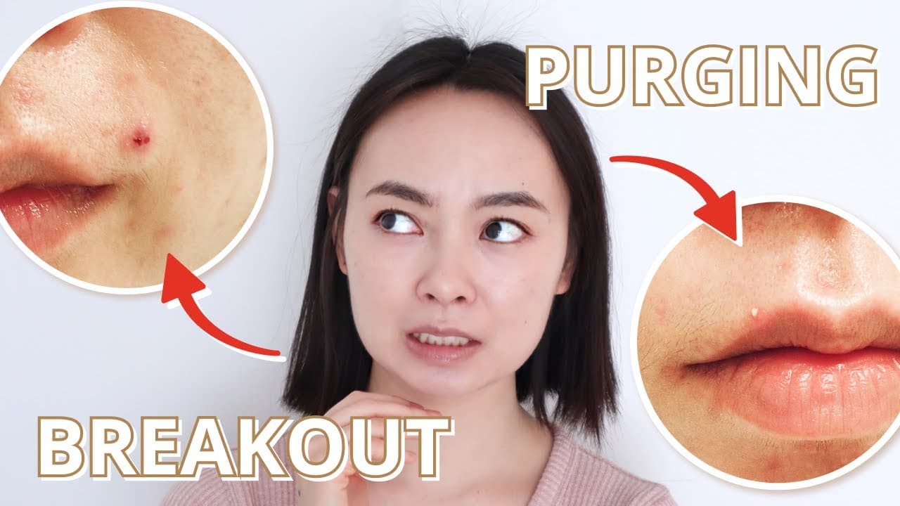 Purging vs Breakout (Chart)