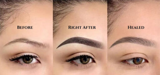 Eyebrow Tattoo Healing Process Pictures Day By Day