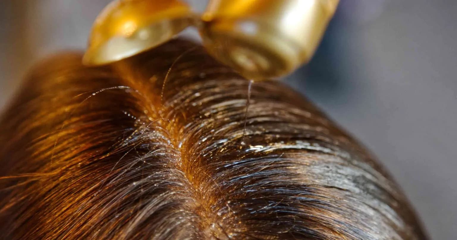 How To Oil Scalp Properly? (Infographic)