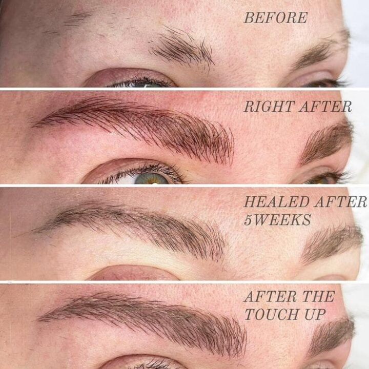 Eyebrow Tattoo Healing Process Pictures Day By Day