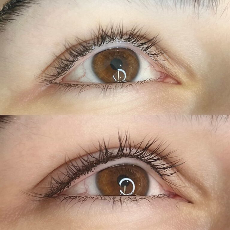 Permanent Eyeliner Before And After Pictures