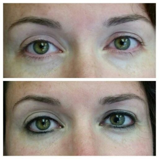 Permanent Eyeliner Before And After Pictures