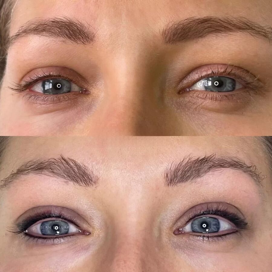 Permanent Eyeliner Before And After Pictures