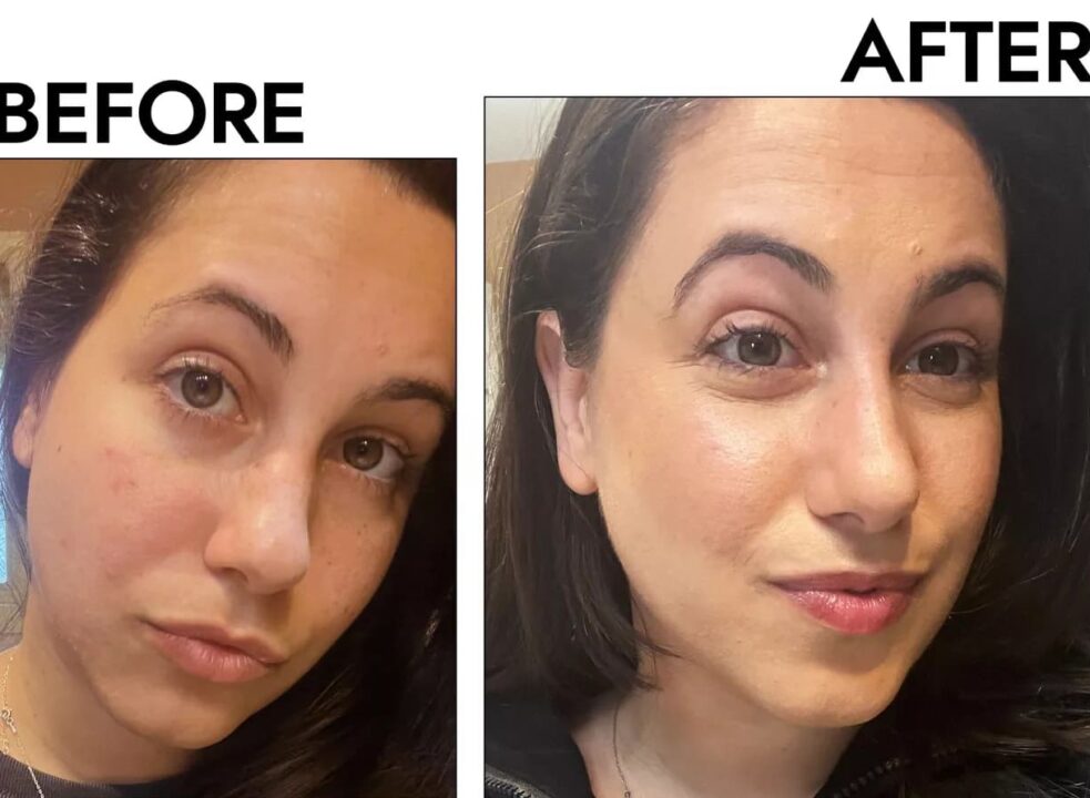 Gua Sha Before And After Photos (Jade, Quartz, and More)