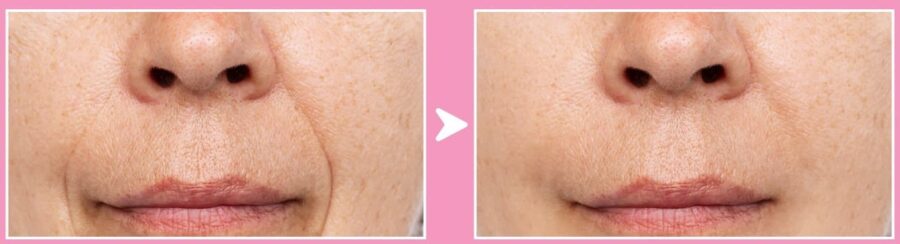 Gua Sha Before And After Photos (Jade, Quartz, and More)