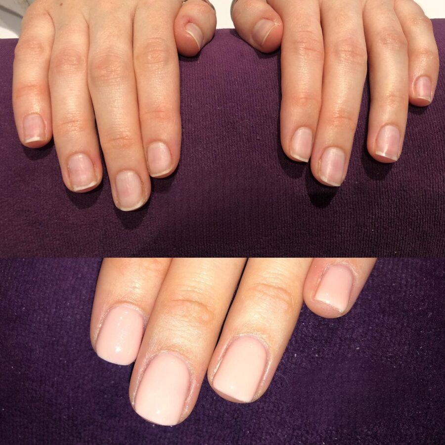 Builder Gel Nails Before And After Pictures