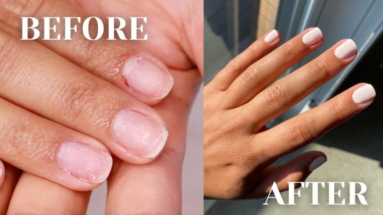 Builder Gel Nails Before And After Pictures