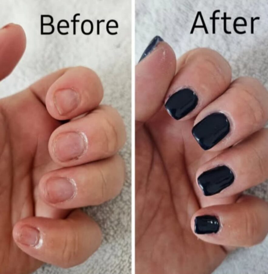 Builder Gel Nails Before And After Pictures