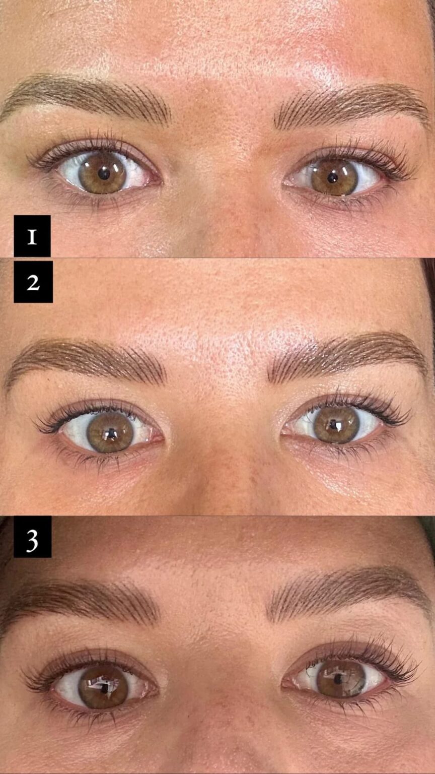 Nano Brows Healing Process With Pictures