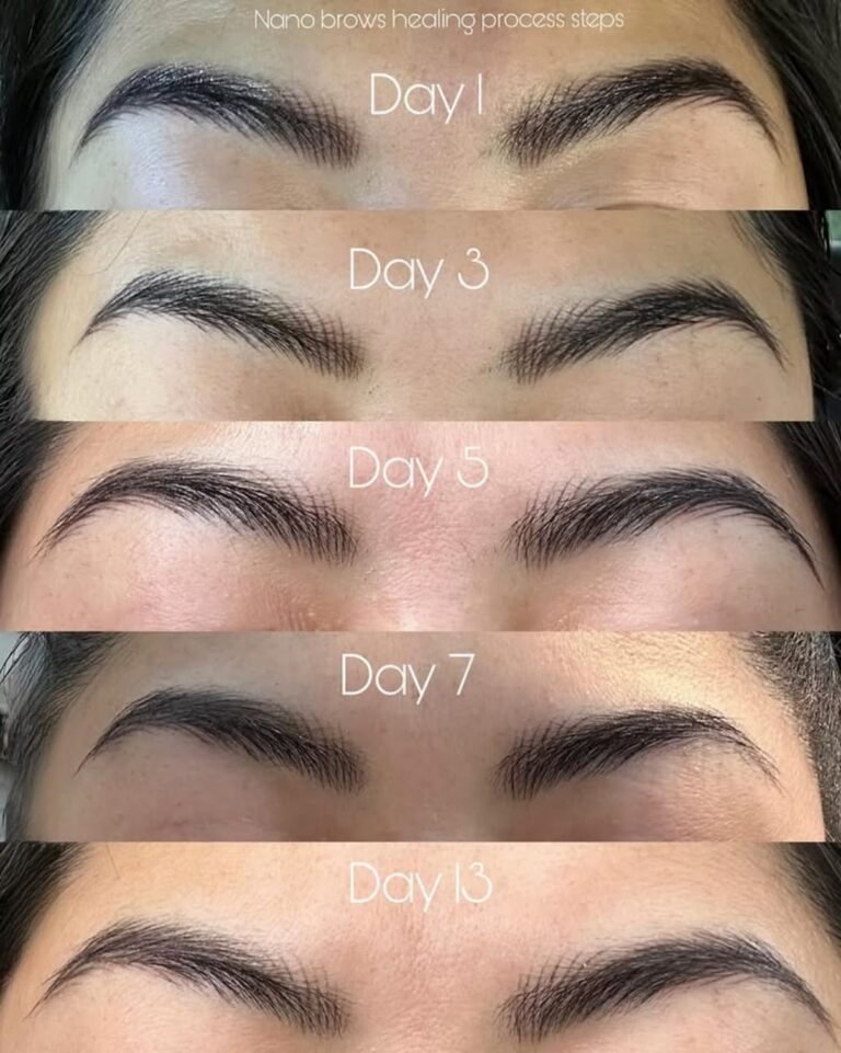 Nano Brows Healing Process With Pictures