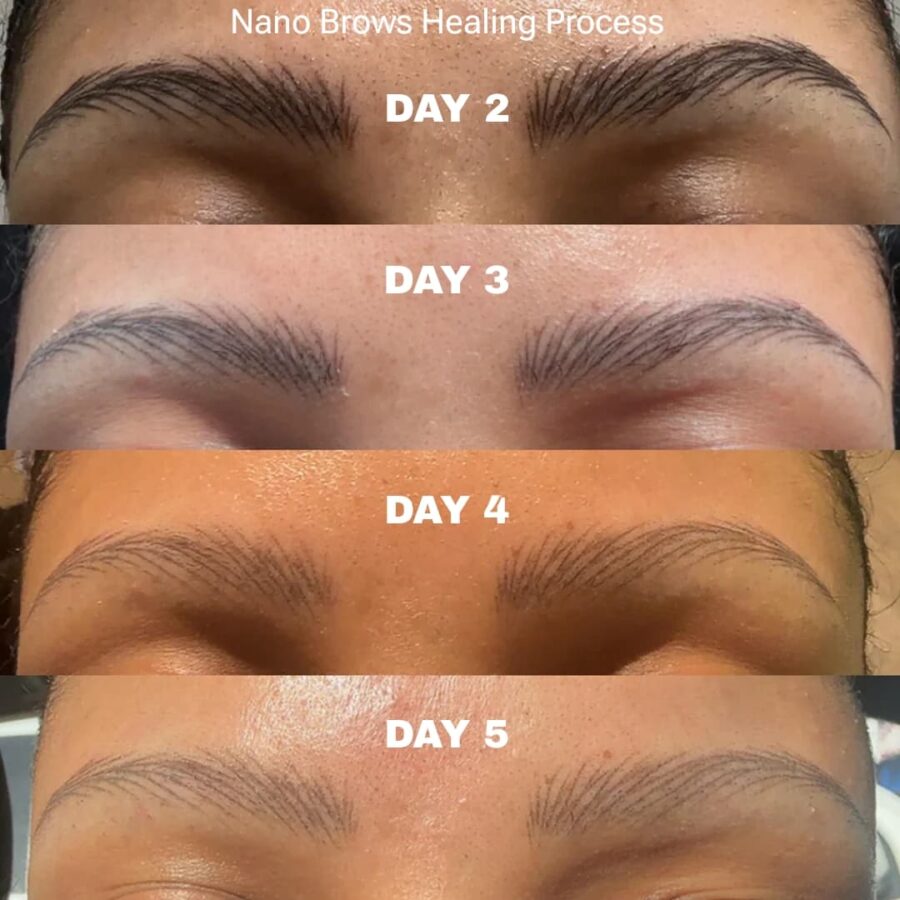 Nano Brows Healing Process With Pictures
